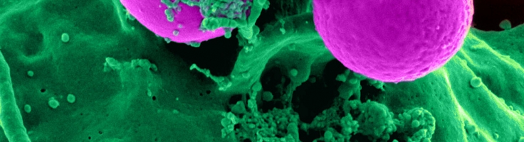 World MRSA Day - The Ongoing MRSA Epidemic - Trana Discovery